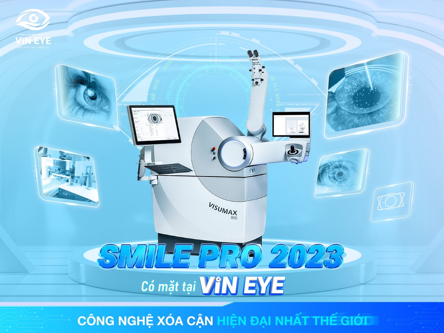 So sánh phương pháp mổ cận SMILE PRO với ReLEx SMILE - BỆNH VIỆN MẮT ...