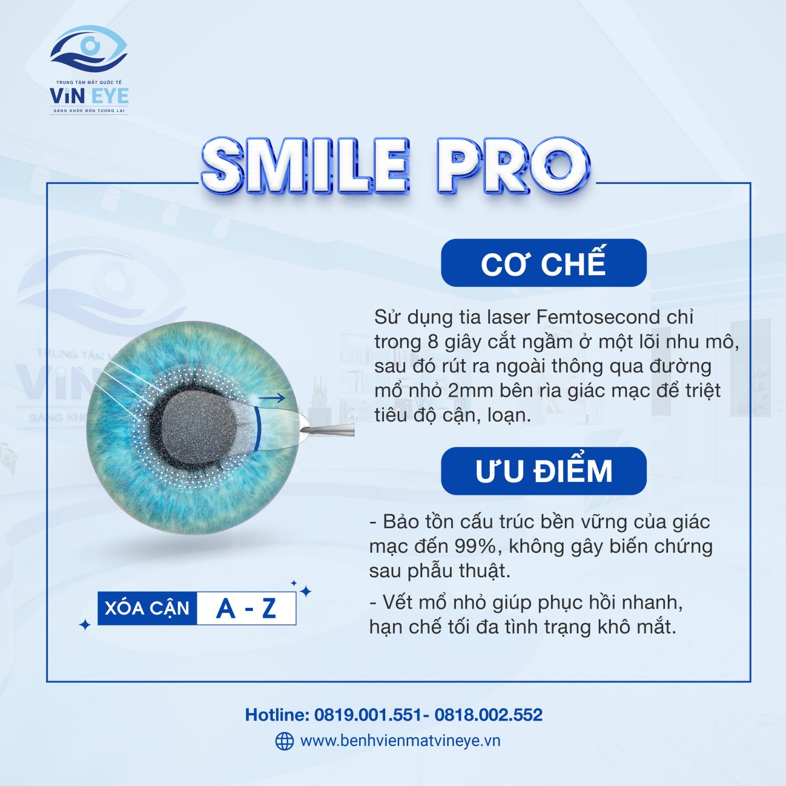 So sánh phương pháp mổ cận SMILE PRO với ReLEx SMILE - BỆNH VIỆN MẮT ...