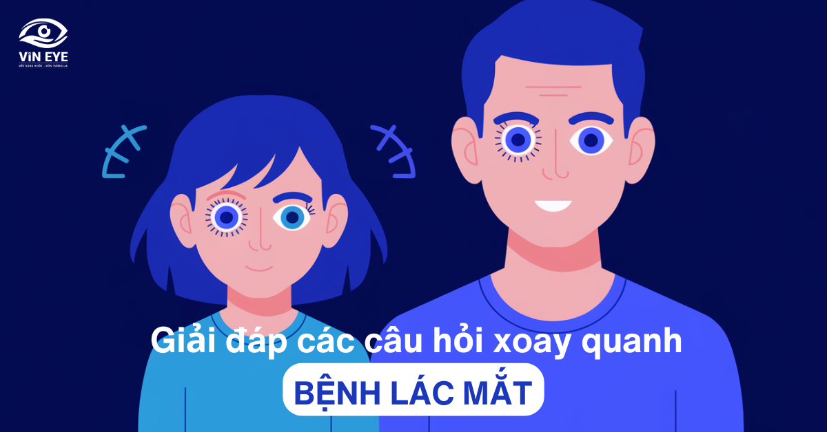 Giải đáp các câu hỏi xoay quanh bệnh mắt lác - BỆNH VIỆN MẮT QUỐC TẾ VINEYE